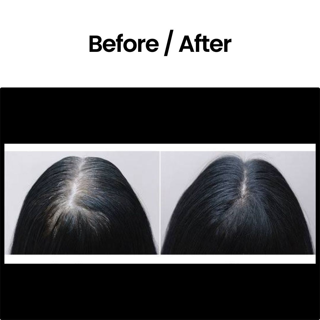 Intense Hair Growth Serum for Hair Fall Control Boost Density (30ml ...